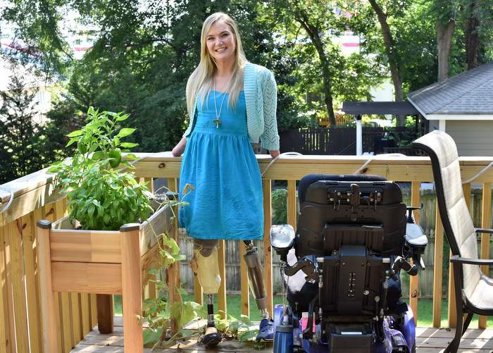 Aimee Copeland's fight for her life